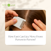 How Fast Can Lice Move From Person to Person?